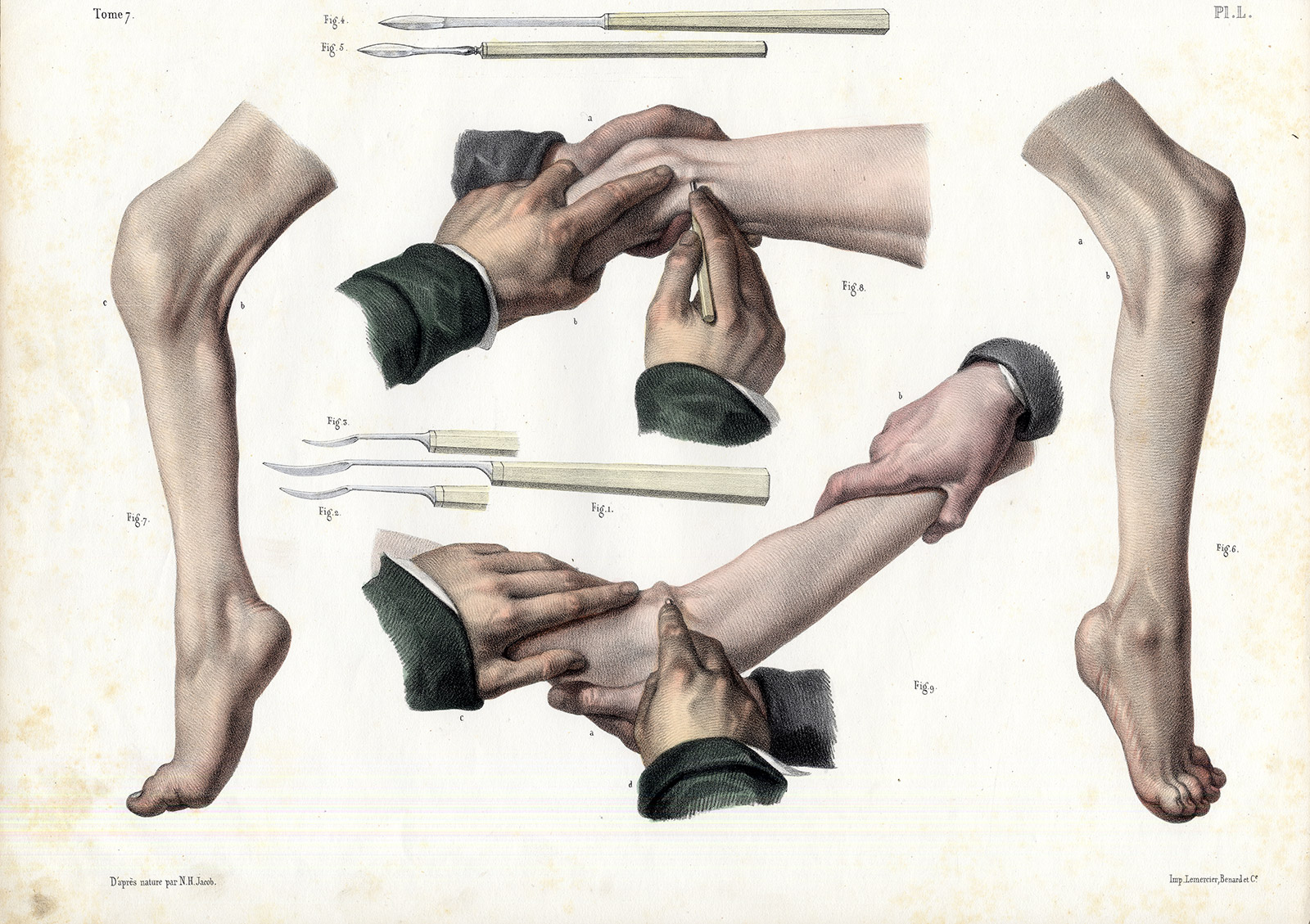 2 Antique Medical Anatomy Prints-TENOTOMY-SURGICAL INSTRUMENTS-P L ...